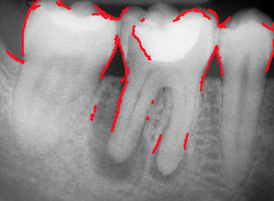 Contour Feature Detector Not Giving Desired Result OpenCV Q A Forum